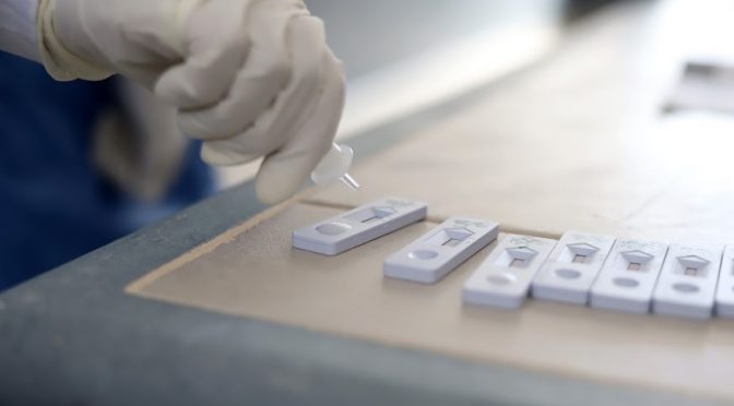 SALUD | Aplica SSM pruebas gratuitas de COVID-19 en Morelia SALUD | Aplica SSM pruebas gratuitas de COVID-19 en Morelia